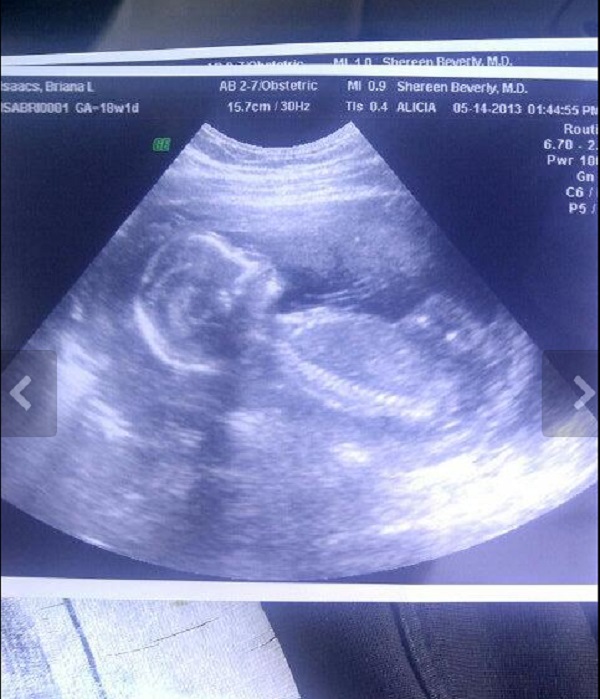 Kendu Issac's pregnant homeless daughter blasts him on Twitter