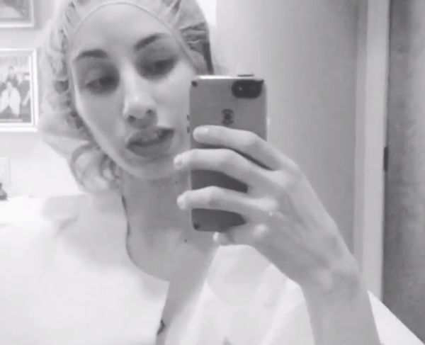 Kat Stacks posts Instagram pics of her body after plastic surgery