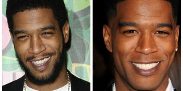 5 Rappers That Got Traded In Grills For Perfect Teeth