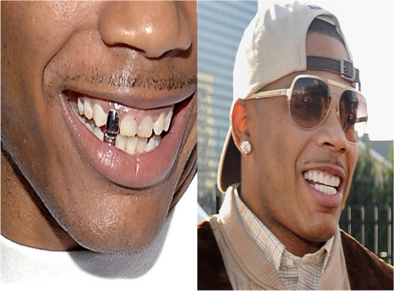 5 Rappers That Got Traded In Grills For Perfect Teeth
