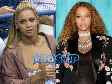 Has Beyonce Gotten Her Grammy Winning Pout Plumped Full Of Lip Filler?