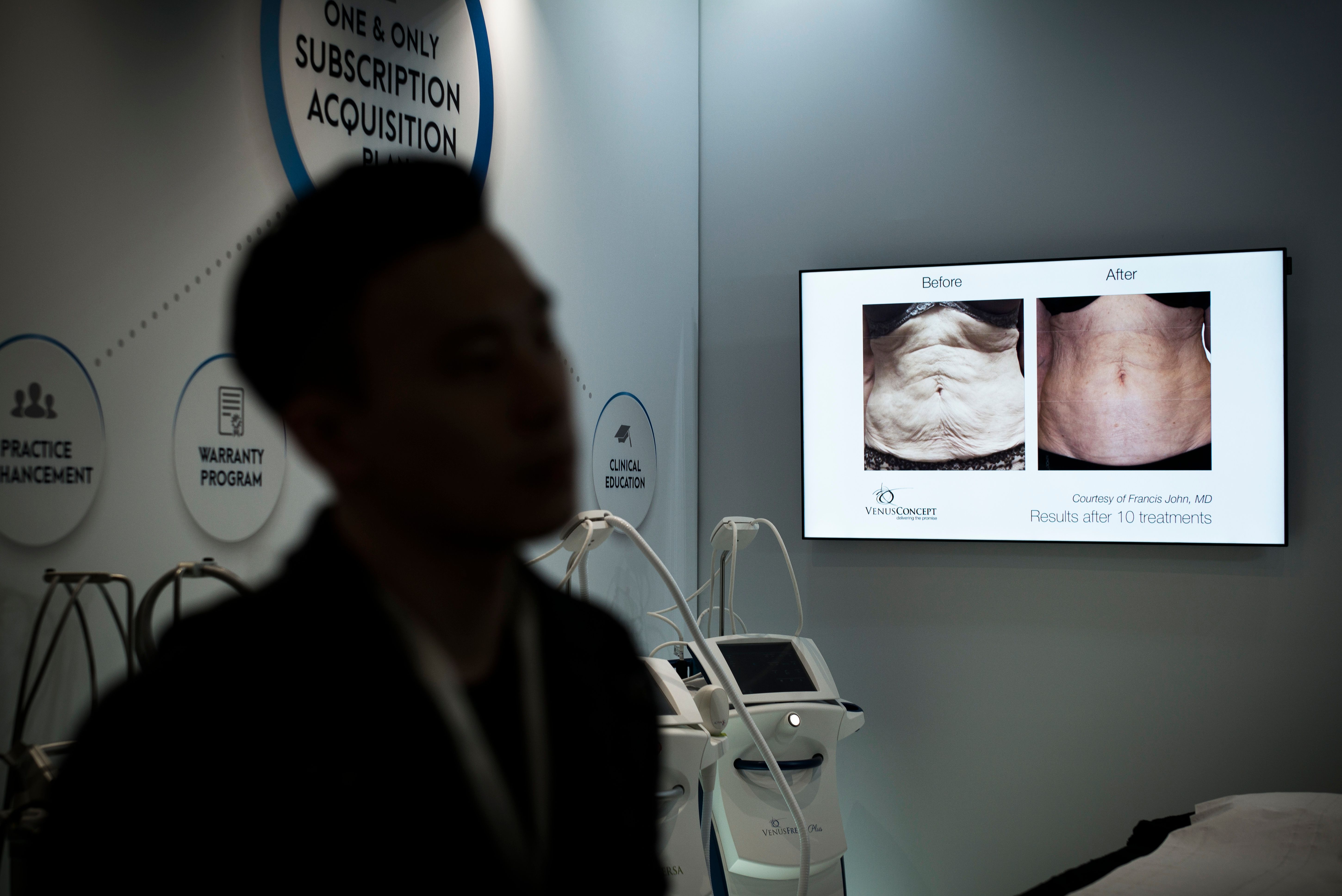 An "Introverted" Dancer Is Plastic Surgery Addict