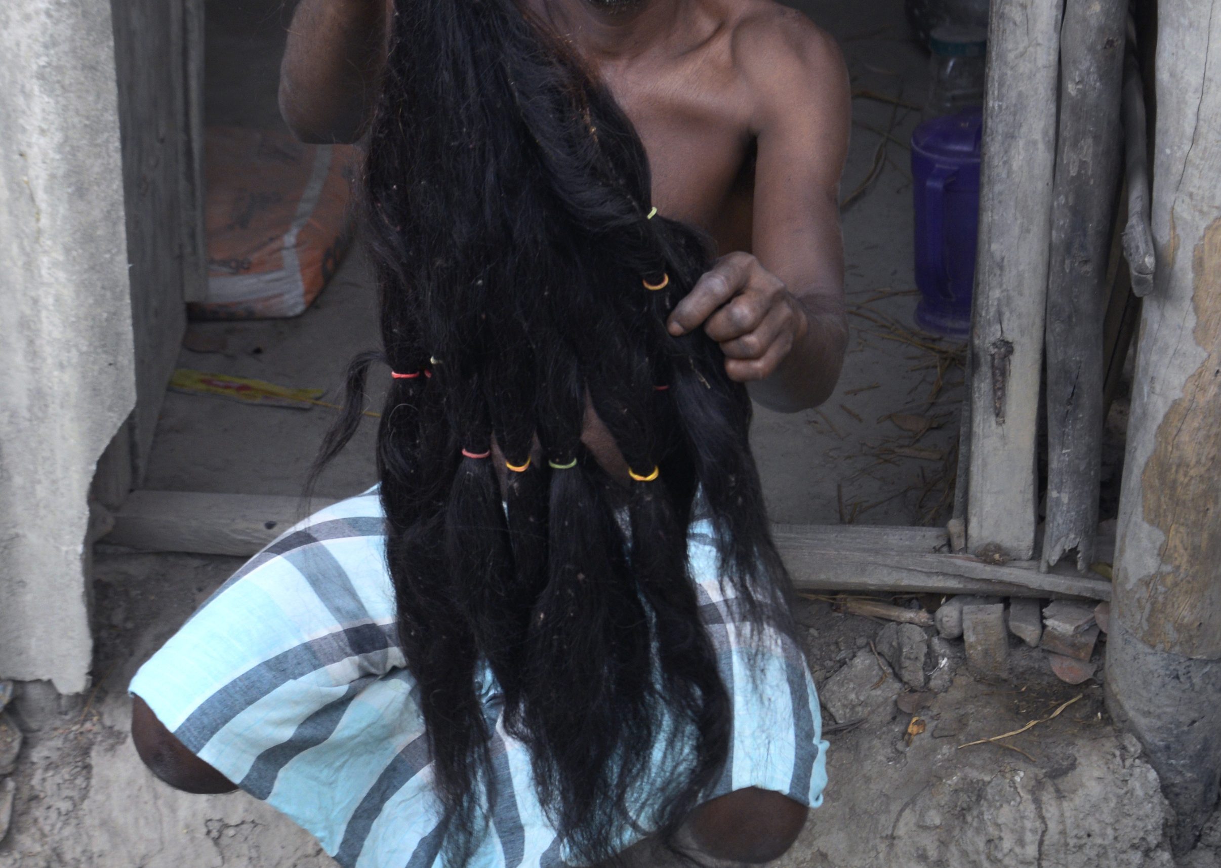 Beautiful Burn Victim Lets Her Crush Remove Her Wig & Makeup