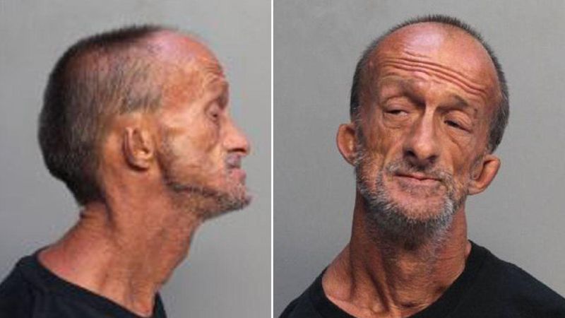 Miami Man Without Arms Charged With Using Scissors To Stab Tourist