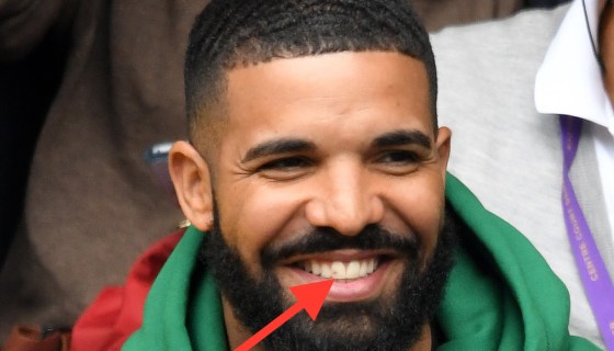 Drake has something in his teeth while he roots for Serena Williams ...