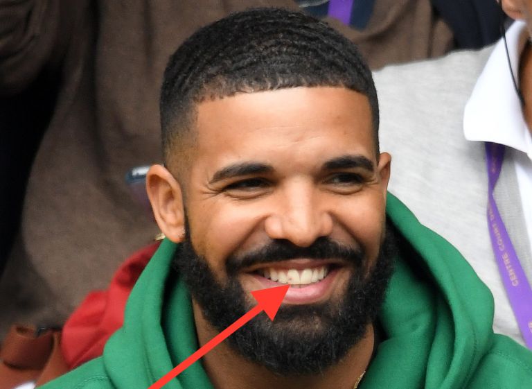 Drake has something in his teeth while he roots for Serena Williams